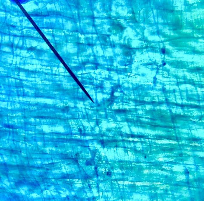 Observations microscopiques de nerf sciatique et de muscle – Innover en SVT