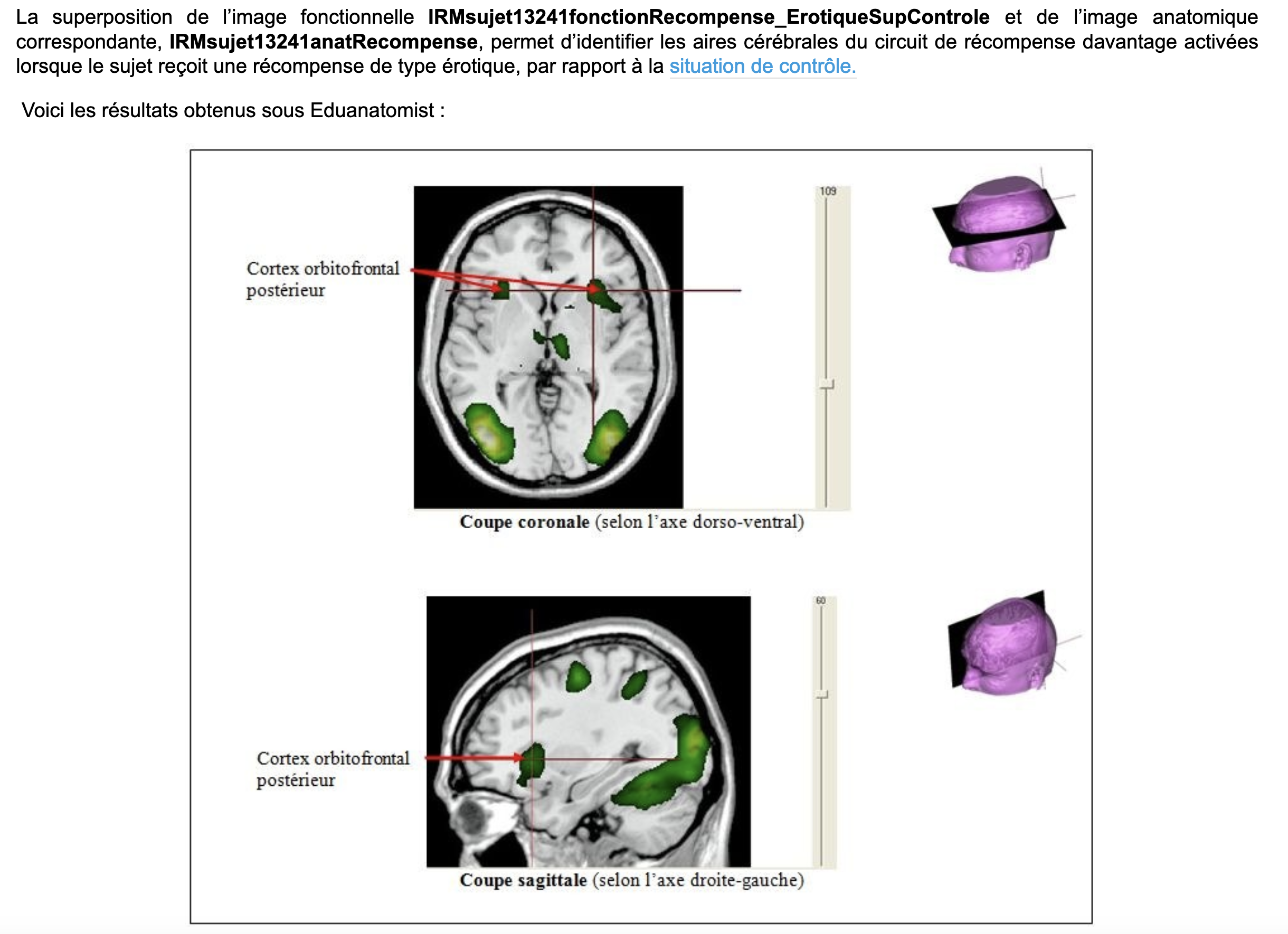Tspé SVT/Chapitre 9/Le cerveau, un organe fragile – Innover en SVT