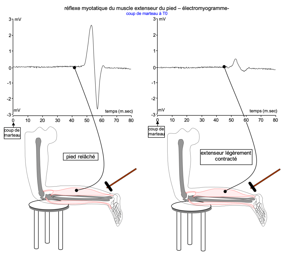 TSpé SVT/TP/Enregistrer la réponse du muscle extenseur lors du réflexe ...